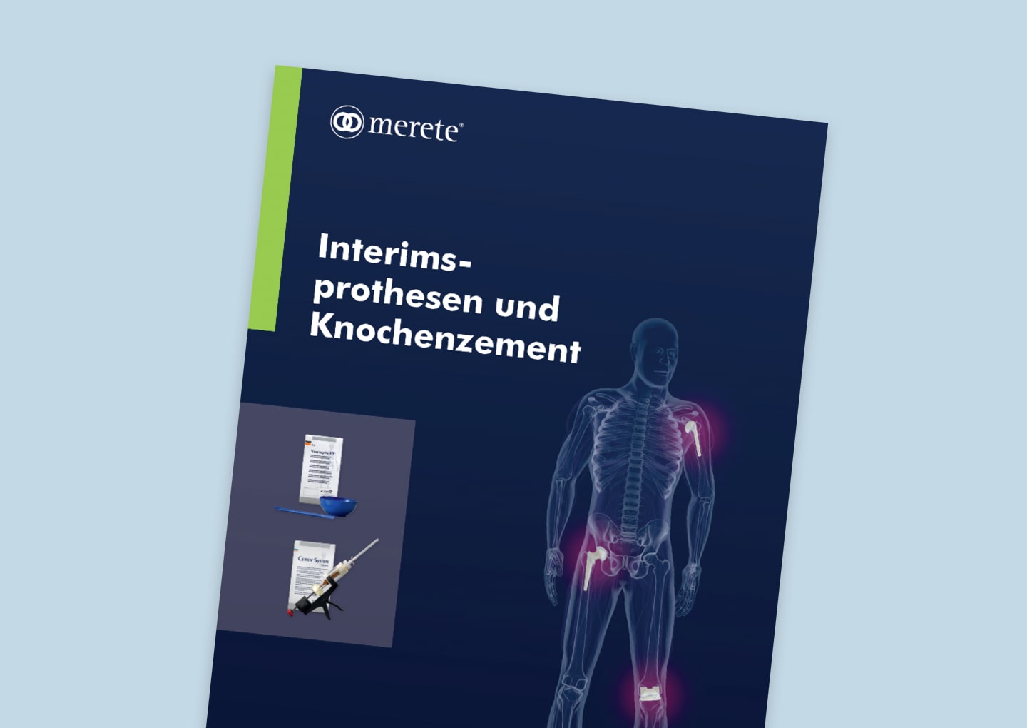 Spacer and cement media library – Merete GmbH
