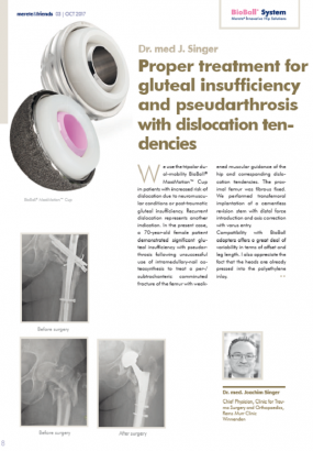 BioBall® System media library – Merete GmbH